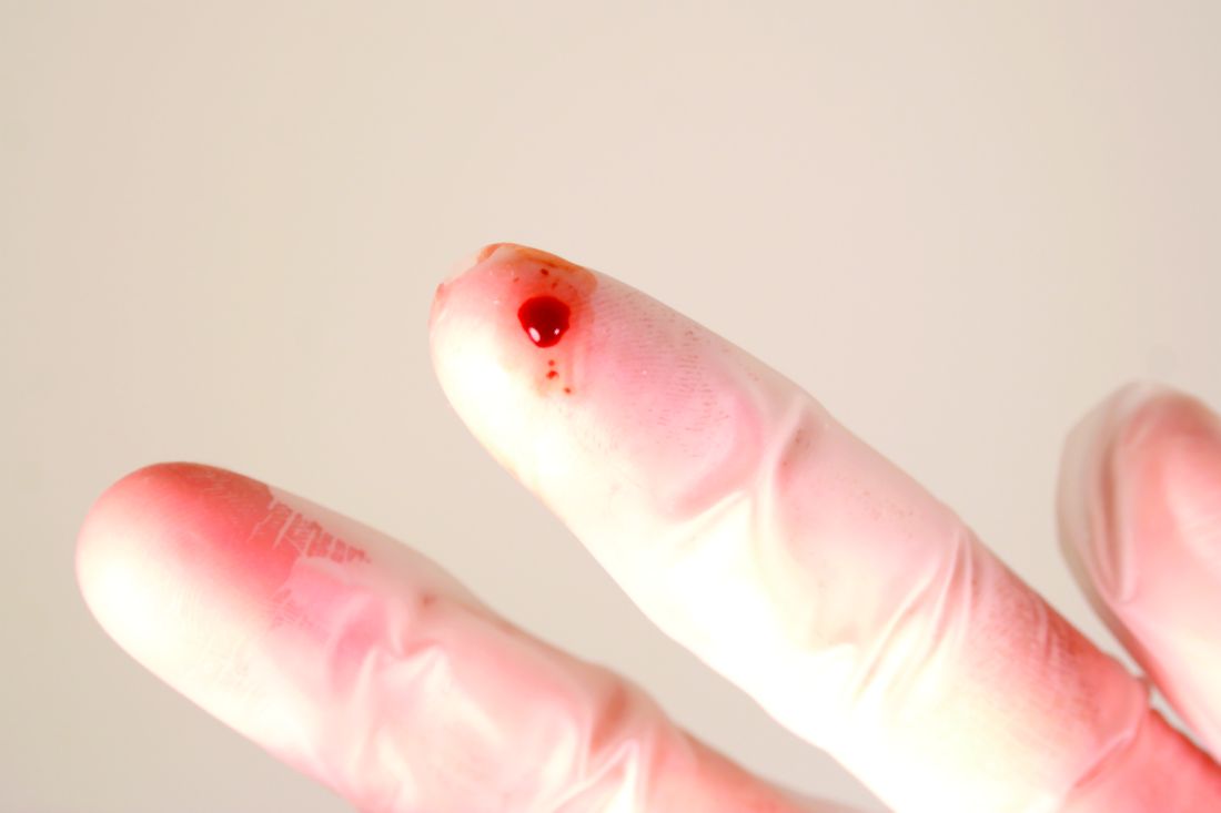 Monthly needlestick rates suggest a steep learning curve - The Hospitalist